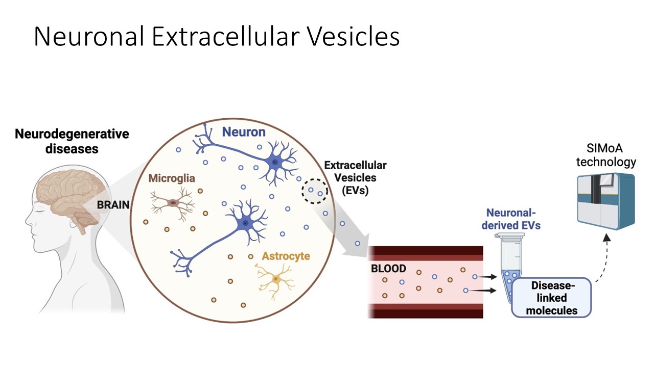 New study focus in molecular biomarkers to identify Alzheimer’s Disease ...